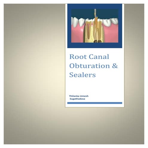Techniques of Root Canal Obturation | PPTX