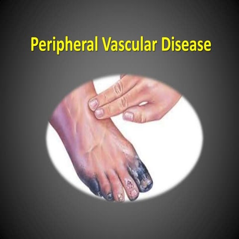 Peripheral vascular disease and Clinical features of acute and chronic ...