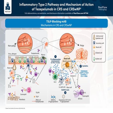 Uncovering the Role of Epithelial Cytokines in CRSwNP: Examining the ...