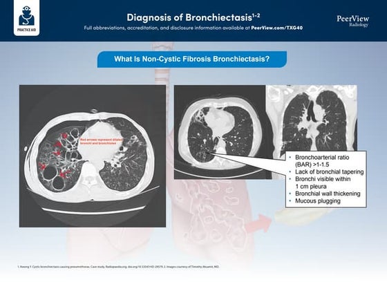 Bridging the Gap to Improved Outcomes in Non-Cystic Fibrosis ...