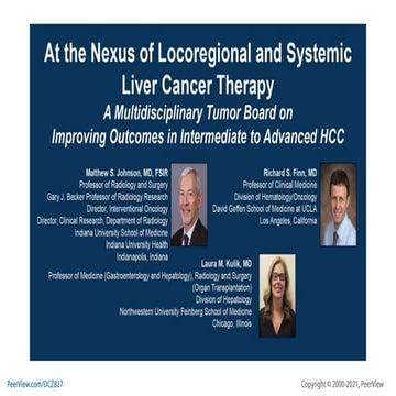 At the Nexus of Locoregional and Systemic Liver Cancer Therapy: A ...