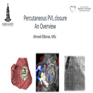 Percutanous PVL closure | PPT