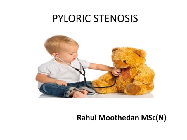 Hypertrophic Pyloric Stenosis | PPTX