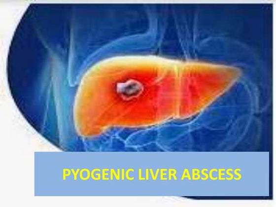 Liver Abscess.ppt | Digestive Disorders | Diseases and Conditions