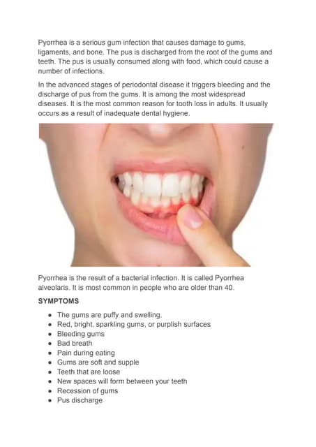 stomatits.pptx | Dental Health | Diseases and Conditions