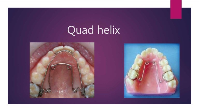 Quad helix