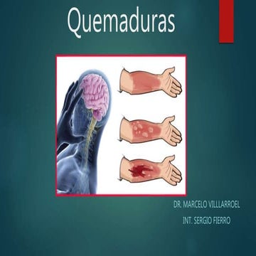 Quemados 5 | PPTX