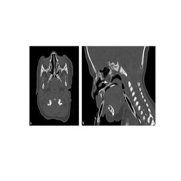 ENT-Image Based Question and Answer.pptx