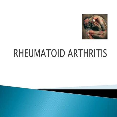 Ra | PPTX | Bone and Joint Conditions | Diseases and Conditions
