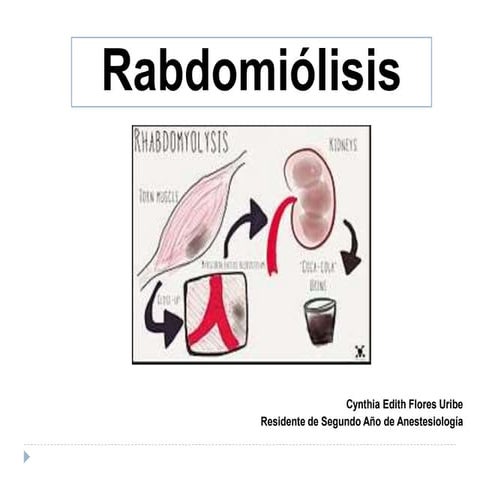 Rabdomiólisis | PPTX
