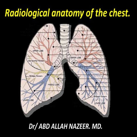 Normal Chest X-ray | PPTX