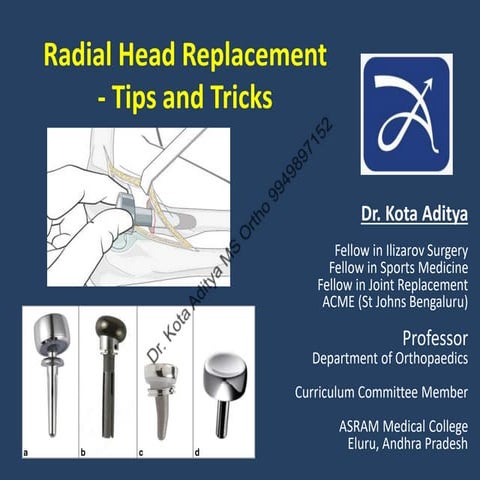 Radial Head Replacement - Surgical Tips and Tricks - Dr Kota Aditya | PDF