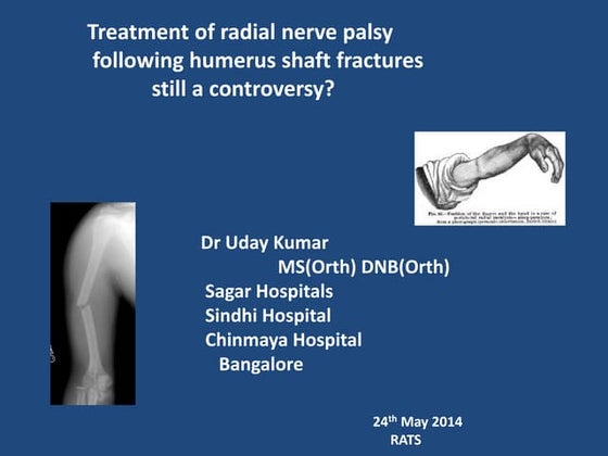 Radial nerve palsy clinical features and diagnosis | PPTX