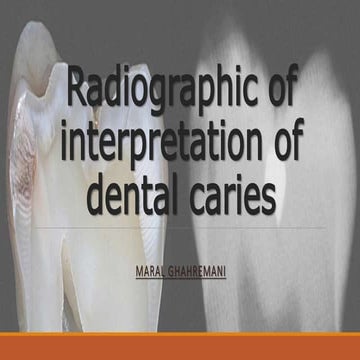 radiographic of interpretation of dental caries | PPTX
