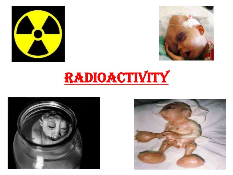 Radioactivity