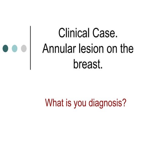 annular lesion on the breast | PPT