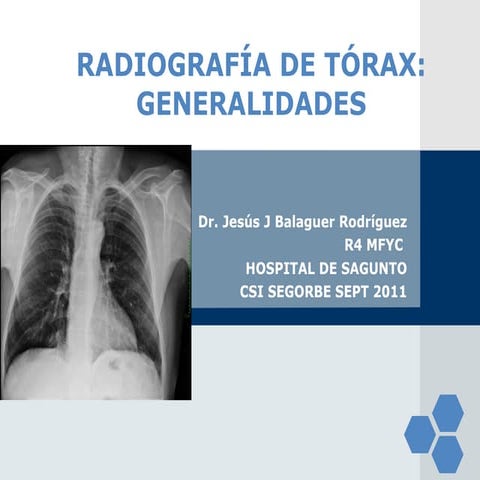 radiografadetrax-111009175502-phpapp01.pdf