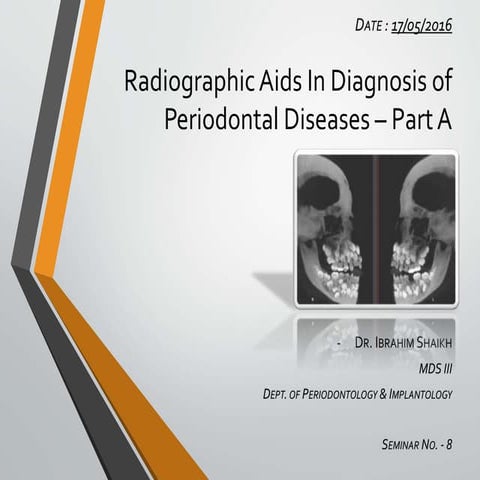 IOPA INTERPRETATION.ppt