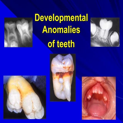 radiographicassessmentofdevelopmentalanomalies-190829211105.ppt