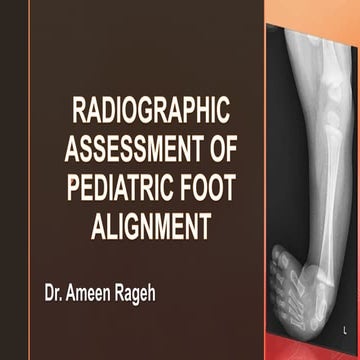 Radiographic assessment of pediatric foot alignment | PPTX