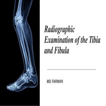 RADIOGRAPHIC TECHNIQUE FOOT.pptx