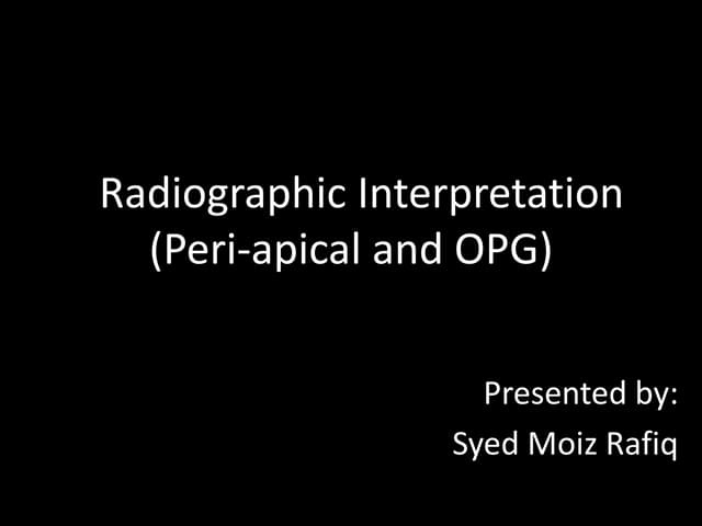 SLOB Technique | PPTX