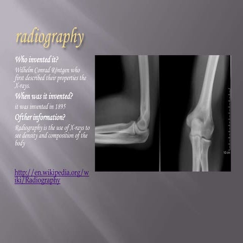 Radiography | PPTX