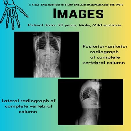 Radiography Images.pdf