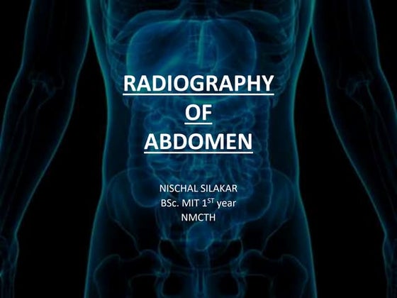 X Ray Normal Abdomen | PPTX