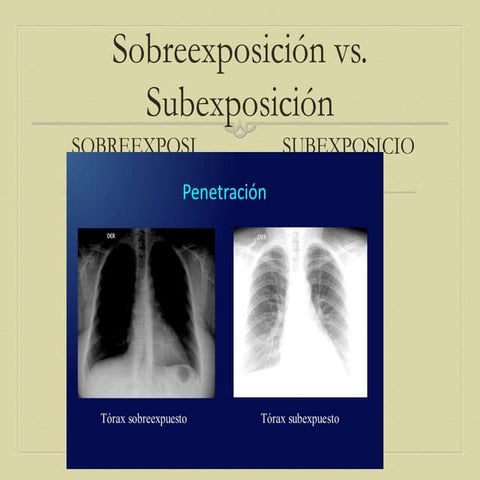 Posiciones radiográficas y proyecciones radiológicas | PDF
