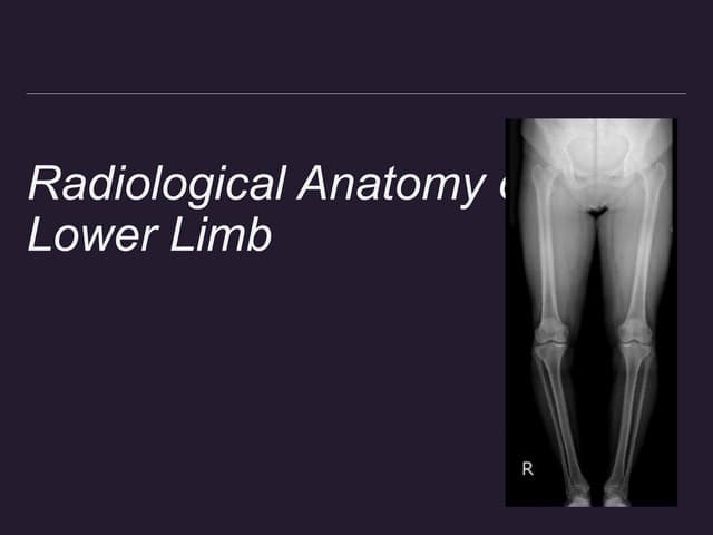 Lower limb radiology | PPTX