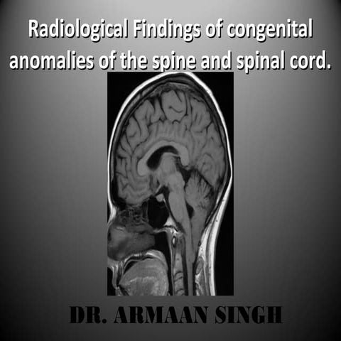 INTRA CRANIAL HEMORRHAGE- AGING BLOOD ON MRI | PPTX
