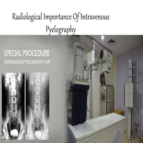 Radiological importance of intravenous pyelography | PPTX