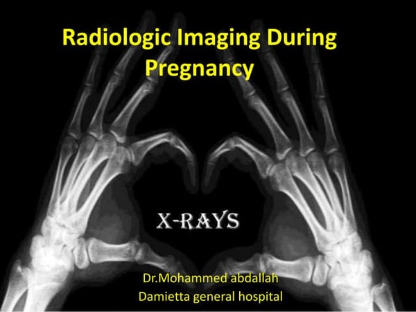 Guidelines For Diagnostic Imaging During Pregnancy