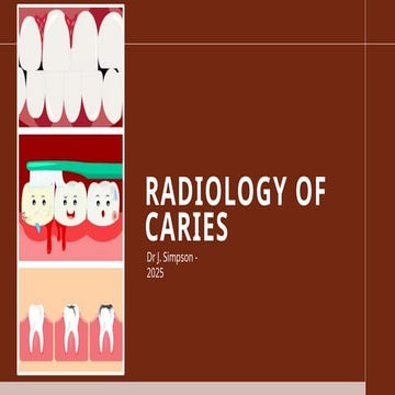 Comprehensive Radiology of Dental Caries: Diagnosis and Classification ...