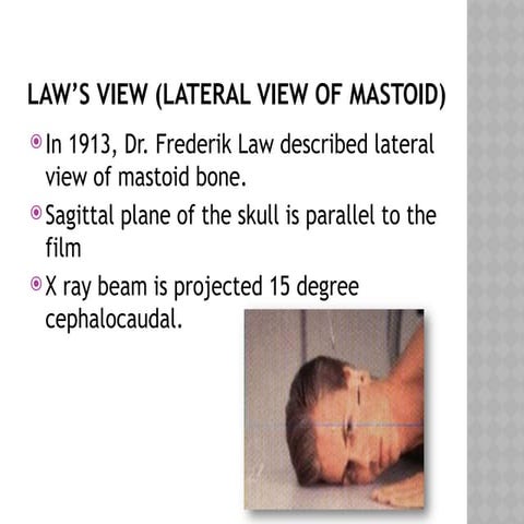 Xrays in ent- Dr Ashly Alexander | PPTX
