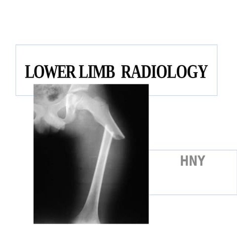 Lower limb radiology | PPTX