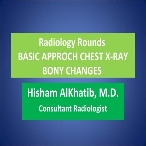 Radiology Rounds Basic Approach to Chest X-Ray , Bony cage , | PPT
