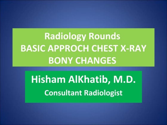 Radiology Rounds Basic Approach to Chest X-Ray , Lateral Chest | PPT ...