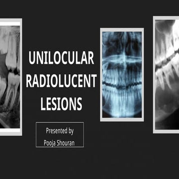 Mixed radiopaque & radiolucent lesions of jaw | PPTX