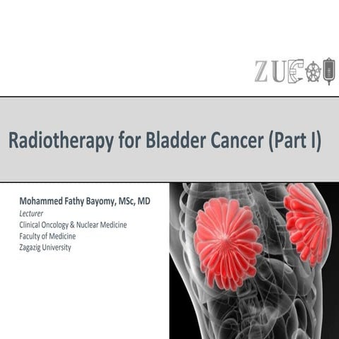 Radiotherapy for bladder cancer part i | PPTX