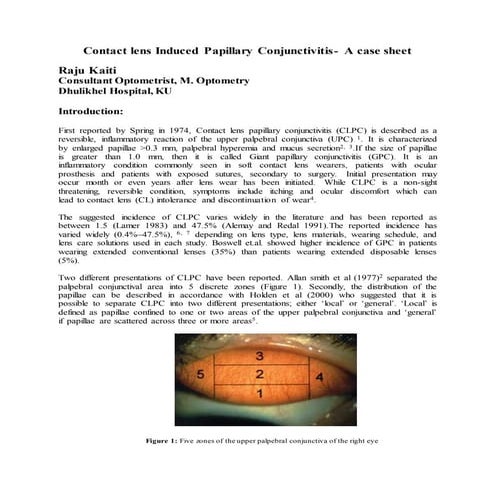 Contact Lens Induced Papillary Conjuncivitis | DOCX