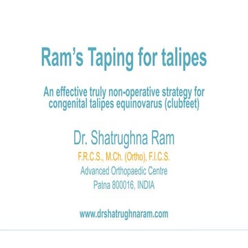 Ram’s Taping for talipes | PPTX