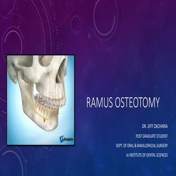 Ramus osteotomy | PPTX