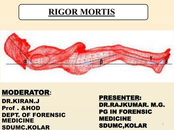 Rigor mortis | PPT