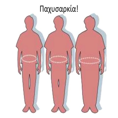 παχυσαρκια | PPTX