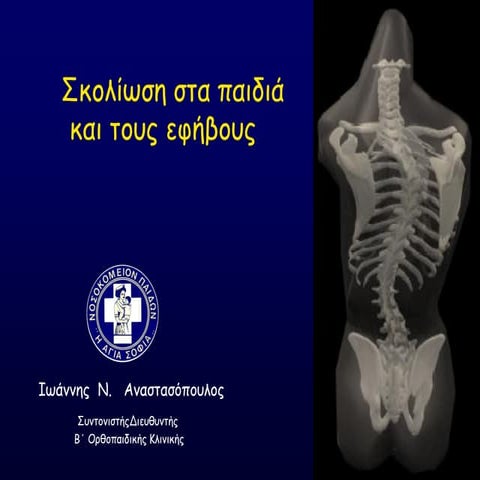 Σκολίωση στα Παιδιά & στους Εφήβους | PDF