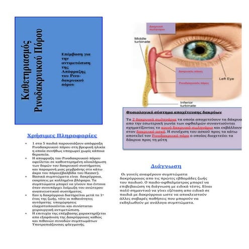 Απόφραξη ρινοδακρυικού πόρου | PDF