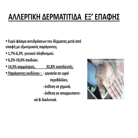 ΔΕΡΜΑΤΙΤΙΔΑ | PPTX