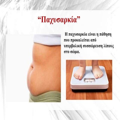 Μεταβολικό σύνδρομο σε παιδιά κι εφήβους | PPTX